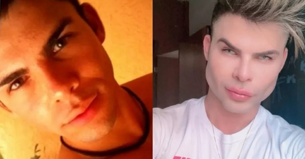 Novo 'Ken Humano' se identifica como 'influencer de estética' e já gastou mais de R$400 mil em ...